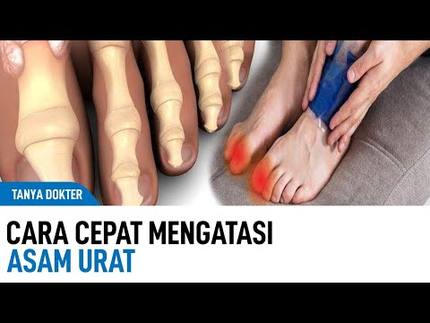 Pertolongan Pertama Saat Nyeri Asam Urat Kambuh | Kata Dokter