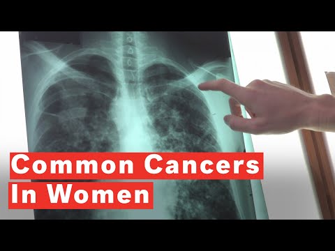 5 Most Common Cancers Affecting Women