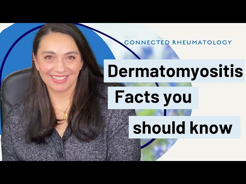 Dermatomyositis Facts your Rheumatologist wants you to know