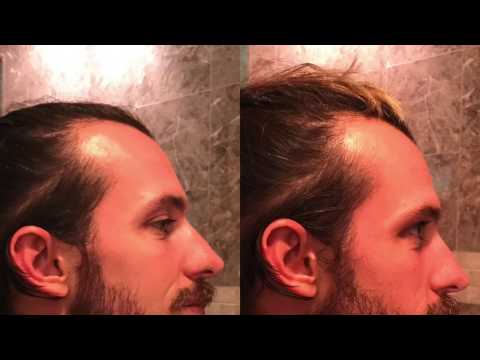 How To Define a New Beard