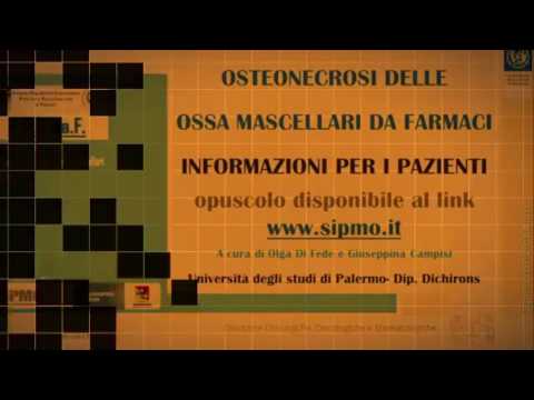 OSTEONECROSI DELLE OSSA MASCELLARI DA FARMACI