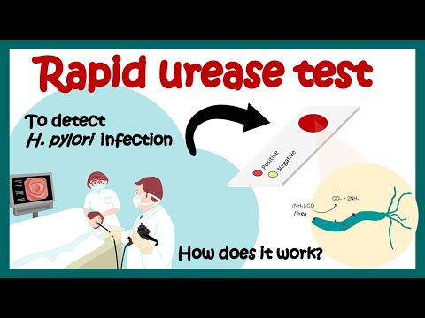 Rapid Urease Test | Rapid Urease test for detecting H Pylori infection | What is Rapid Urease Test?