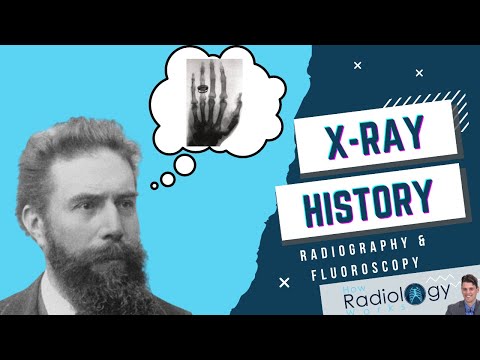 History of X-ray Imaging (Radiography & Fluoroscopy)