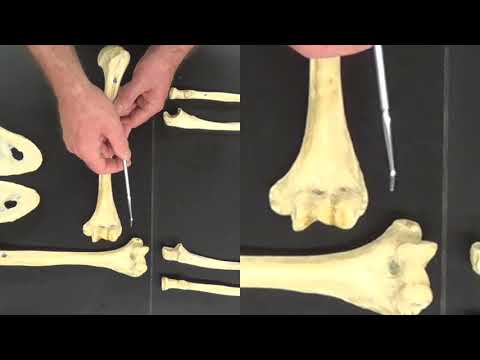 Bones of the upper limb