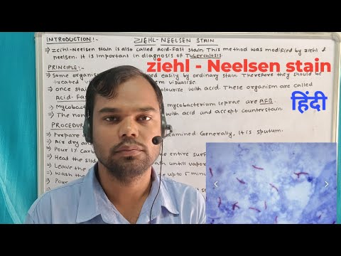 Ziehl Neelsen stain simply explain In hindi