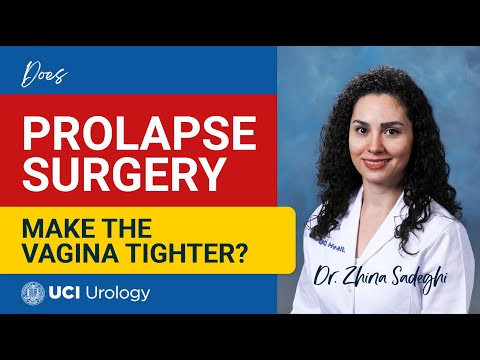 Does Prolapse Surgery Make the Vagina Tighter? by Dr. Zhina Sadeghi - UCI Department of Urology