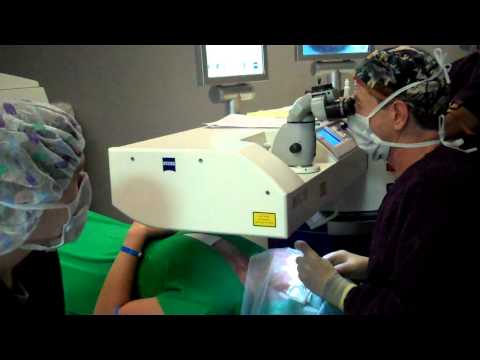 Denver LASIK Surgery - Live