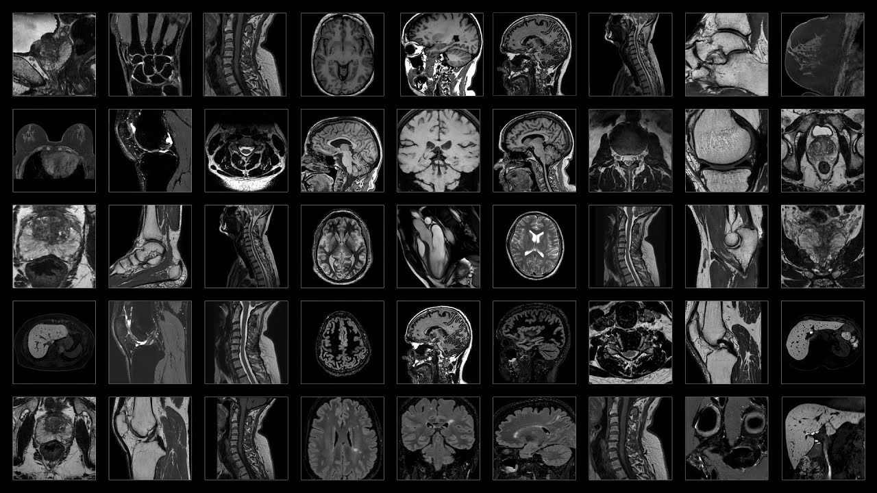 Are you ready for altogether better MR imaging?