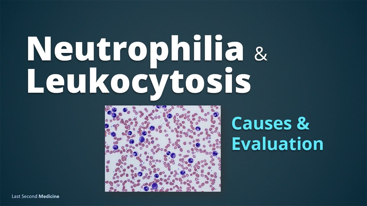 Neutrophilia & Leukocytosis - Pathophysiology of Leukocytosis,  Causes & Evaluation