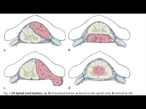 Neurological Semiology