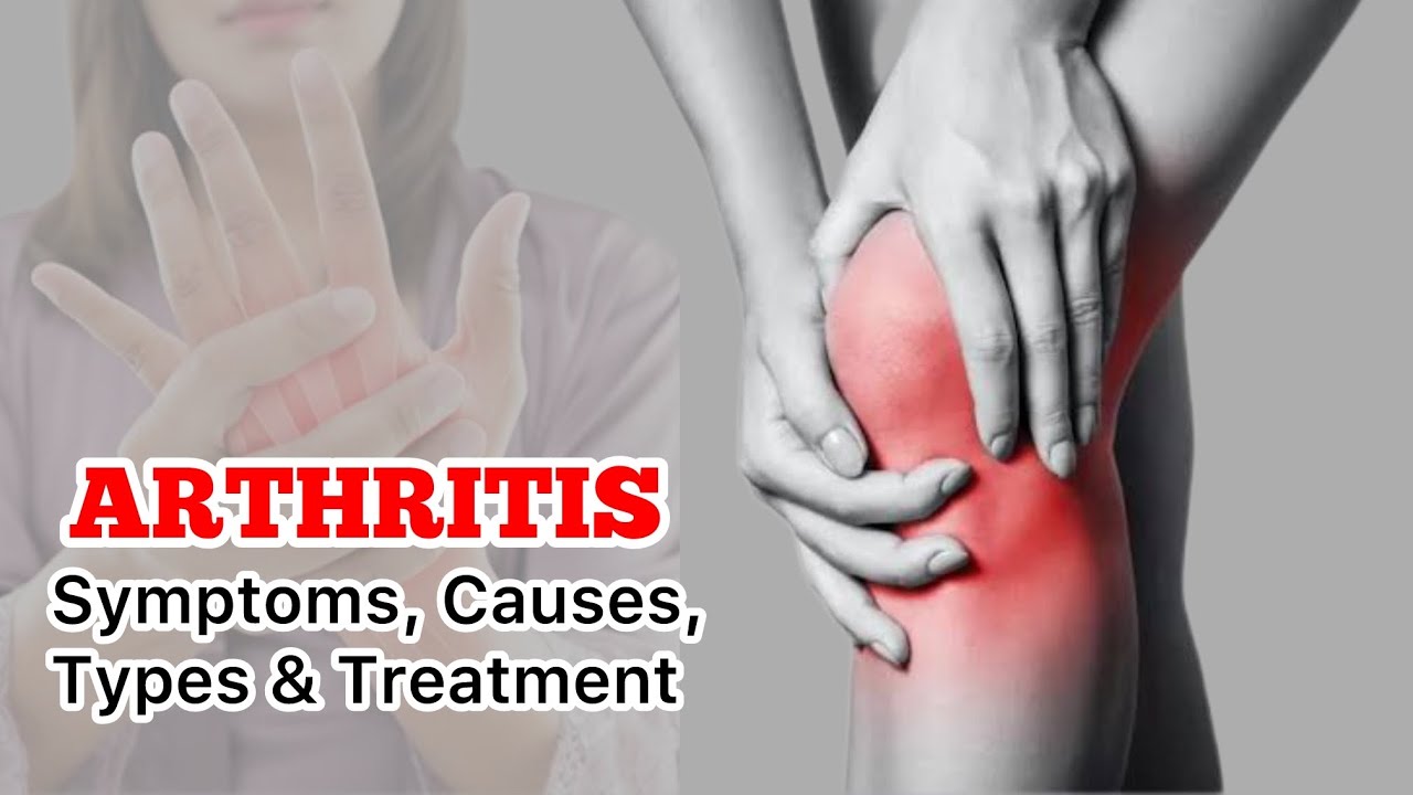 Arthritis: Symptoms, Causes, Types and Treatment