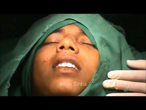 nasal bone fracture reduction under local anesthesia