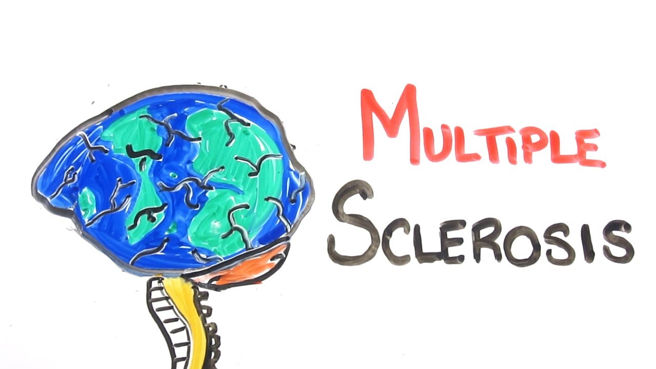 What Is Multiple Sclerosis?