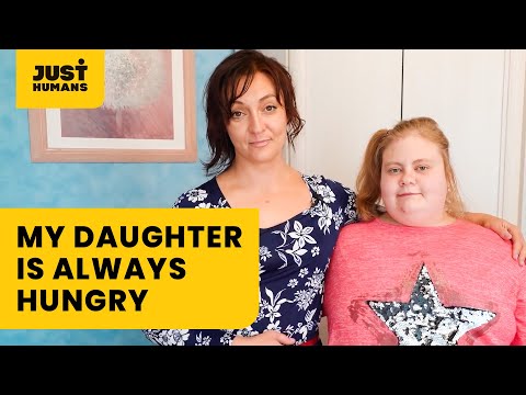 My daughter has Prader-Willi syndrome: Julia | I am a mom