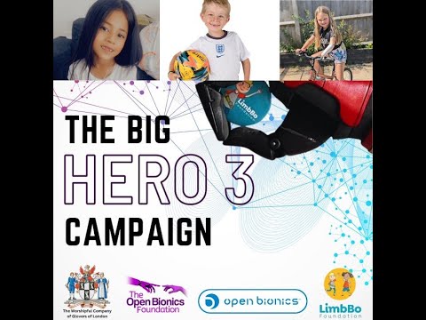 Devon girl born without left hand could have life transformed - Devon Live