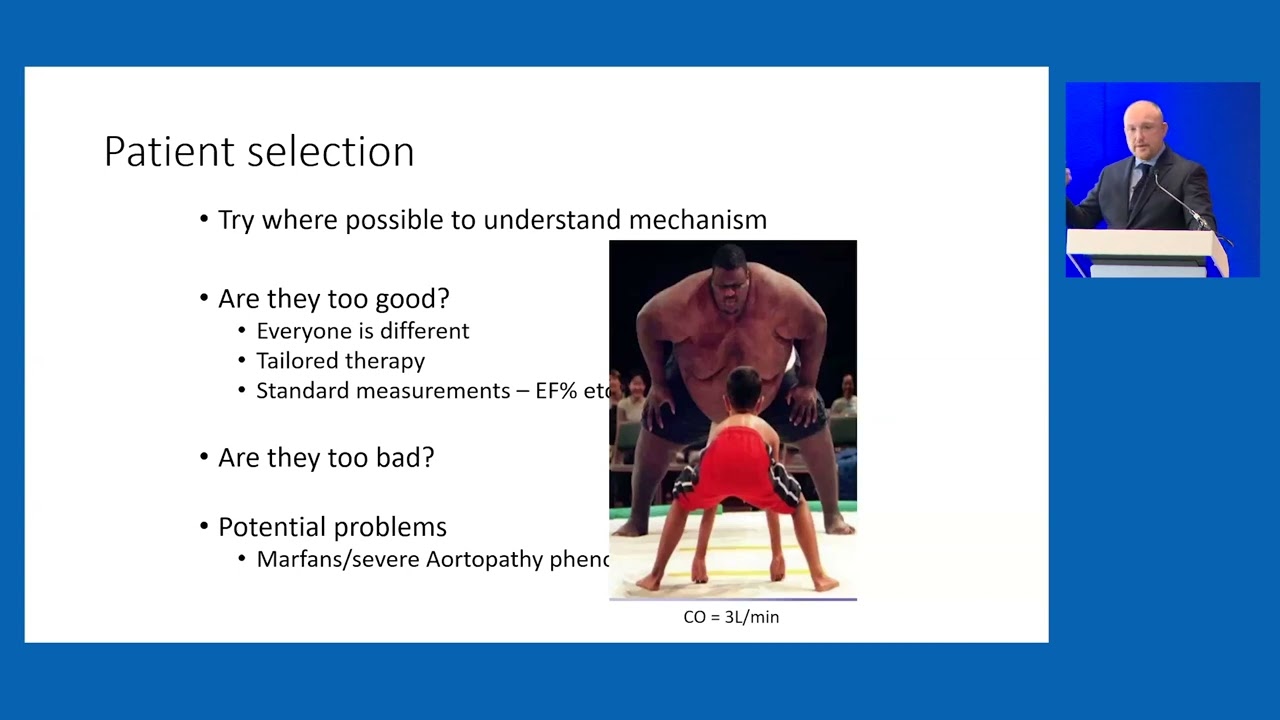 Advanced heart failure therapy Dr Ewan McKay