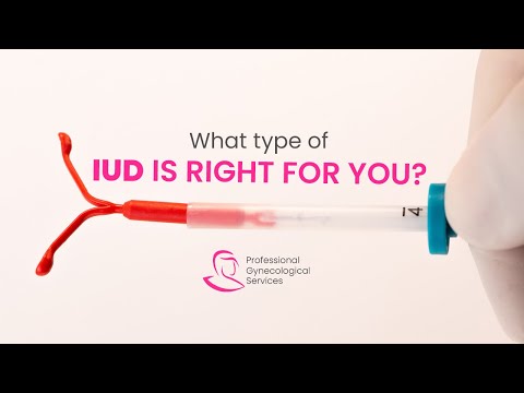 What Type of IUD Is Right For You frame