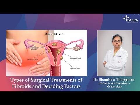 Types of Surgical Treatment of Fibroids & Deciding Factors | Sakra World Hospital