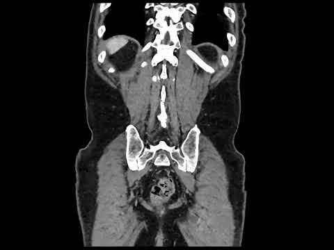 Abdominal Case Conference 2025 - Session 14