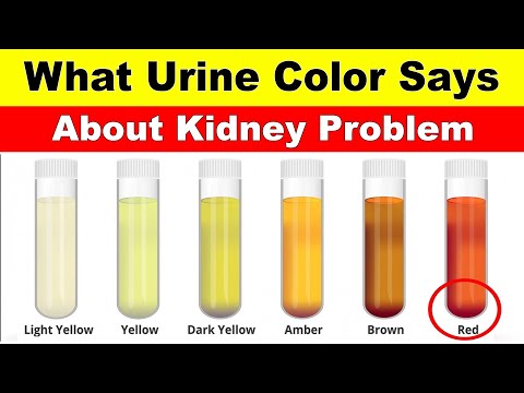 What Urine Color Says About Your Health | Understanding Urine Color and Its Causes