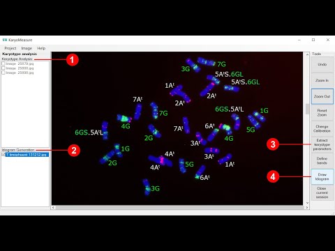 Karyotype analysis using KaryoMeasure