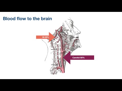 The Vertebral Artery Test Part II: Risk assessment of the cervical spine