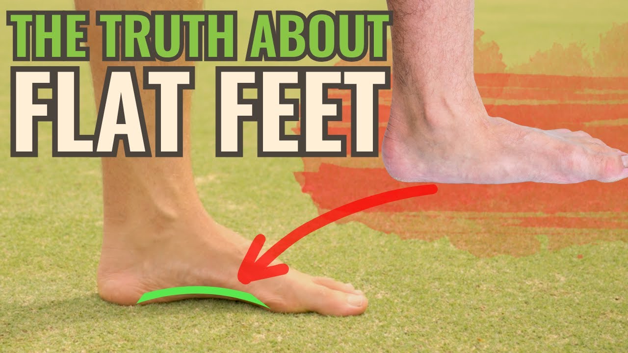 Understanding Flat Feet: Myths, Misconceptions, and Effective Solutions ...