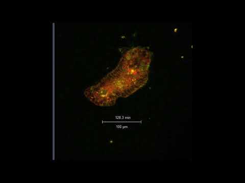Using systems medicine to identify and repurpose a therapeutic agent for Inflammatory Bowel Disease