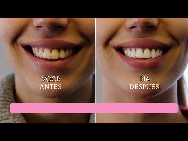 Sparkle Smile® Pen 3 ml - farmaline.be