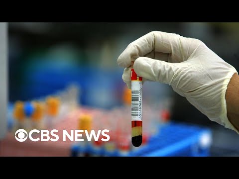 New blood test to detect colon cancer approved by FDA