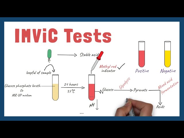 Understanding IMViC Tests: Procedure and Principles in Microbiology ...