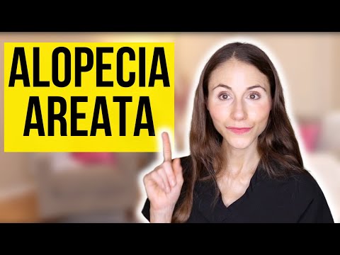 Alopecia Areata Explained | Treatments, Causes, Signs & Symptoms,