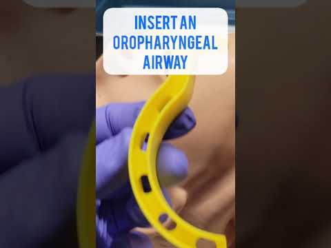 Oropharyngeal Airway (Opa) Insertion | EMS Skills | #shorts