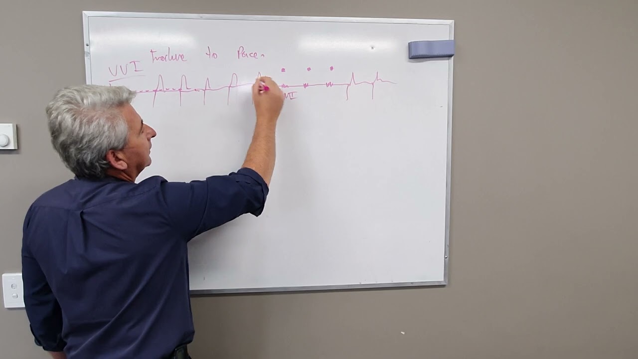 Pacing  Failures made easy