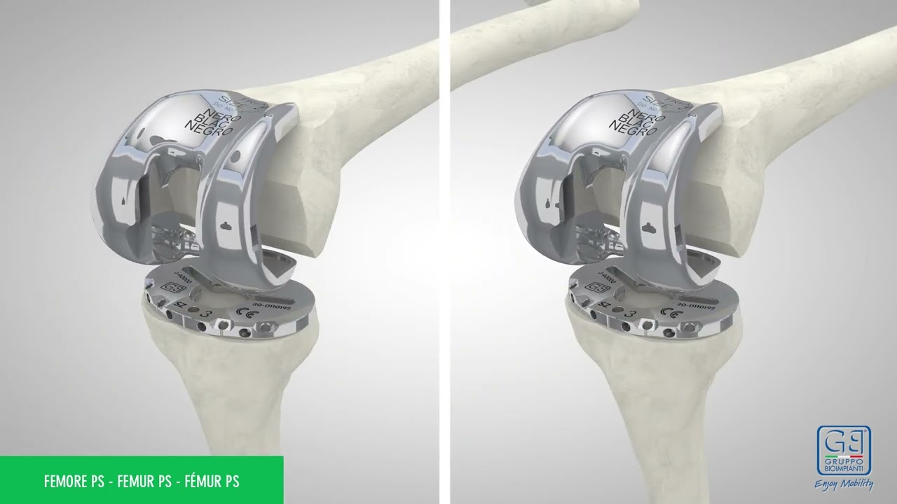 K MOD OPERATING TECHNIQUE ANTERIOR REFERENCE