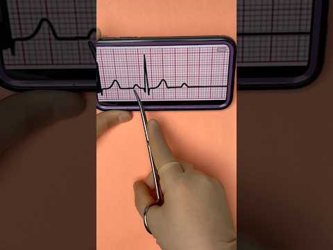 Heart Block Poem ❣️#goodtoknow #mnemonic #heartblock #vet #medicine #surgeonlife #educational #hack