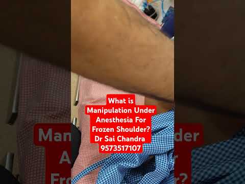 What is Manipulation Under Anesthesia For Frozen Shoulder?Dr Sai Chandra 9573517107