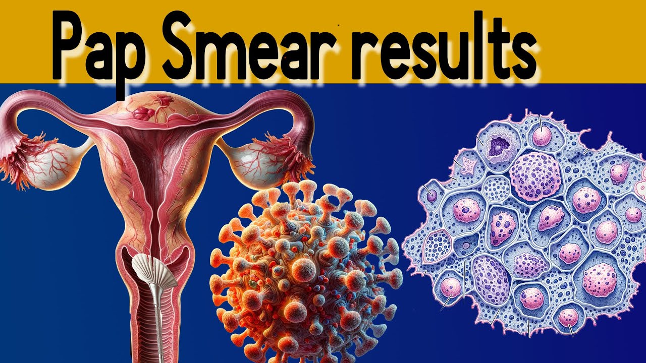 Understanding Pap Smear Results: A Quick Guide | Galaxy.ai