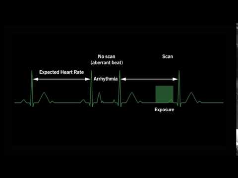 Adaptive Diagnostics SURE Cardio Prospective