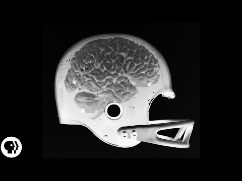 Are Concussions Deadly?
