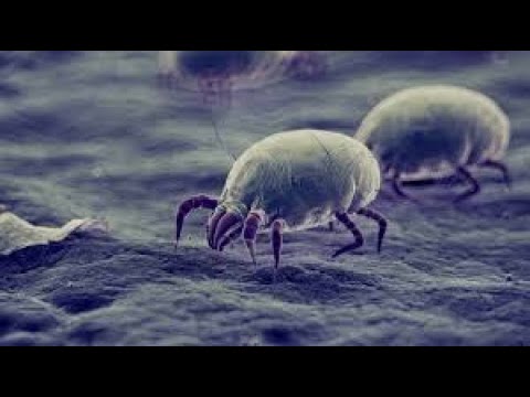 House dust mites microscopic arthropods; Size, Habitat, Allergy symptom, Life cycle