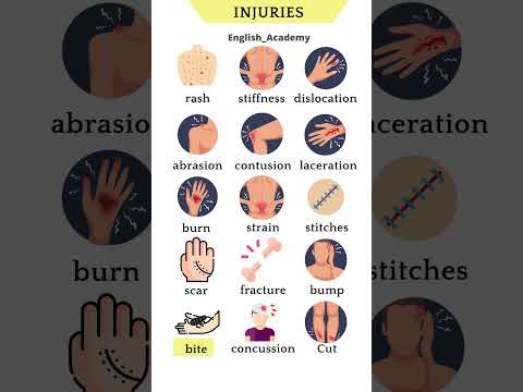 15 common types of injuries in English #shorts