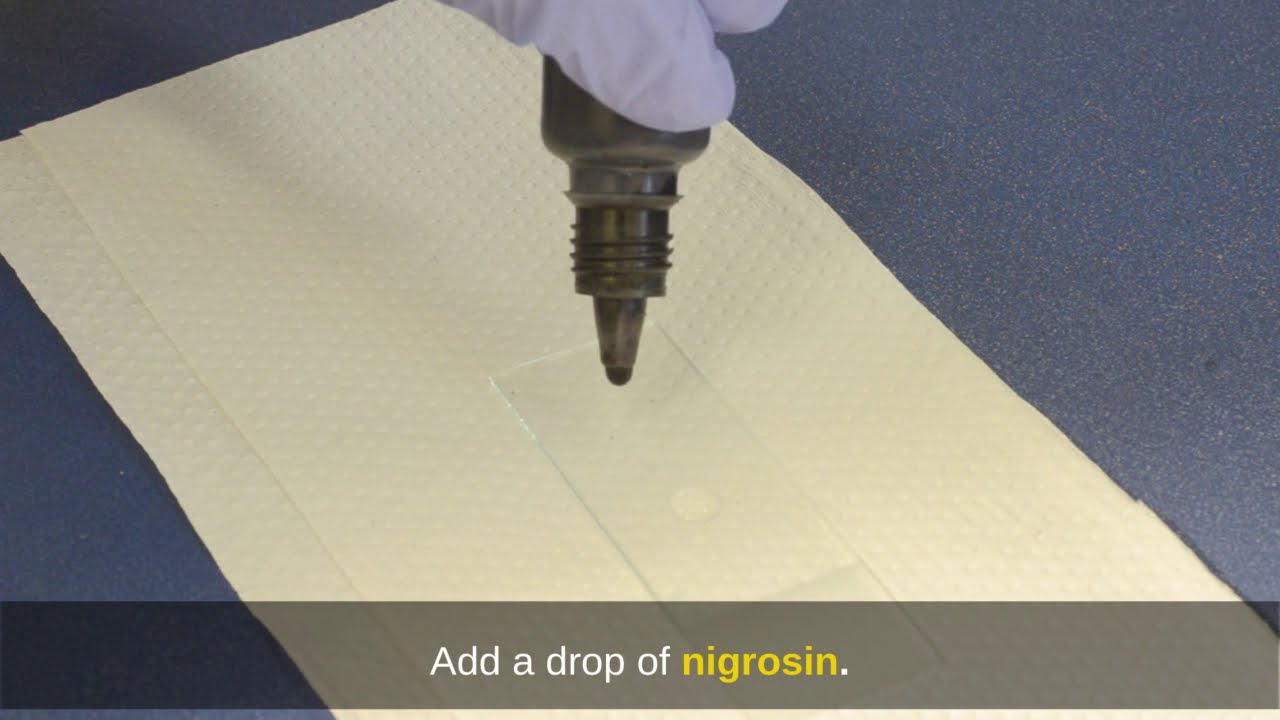Fast nigrosin staining for cryptococcal capsule