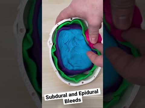 What’s the difference between Subdural and epidural bleeds? #paramedic #paramedicstudent #emtstudent