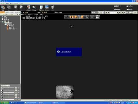 Nidek RS3000 Macular Map.avi