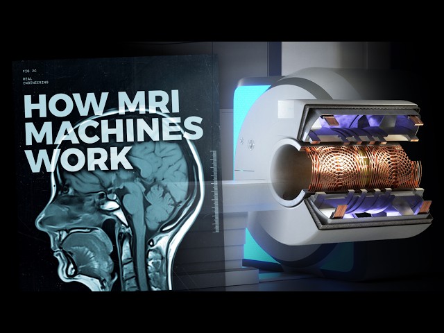 The Insane Engineering of MRI Machines: A Deep Dive into Medical ...