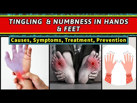 Numbness & Tingling in Hands, Feet _ Causes, Solutions and Preventive Tips