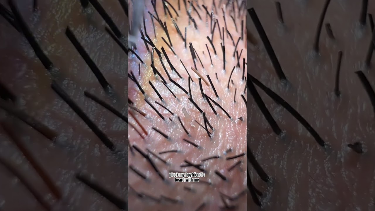 plucking my boyfriend’s thick beard hairs #satisfying #beardlove #skincare #thebeardguys #tweezers
