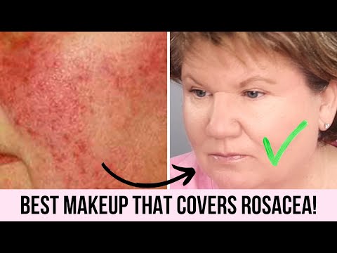 Hiding Rosacea in 5 Minutes: The Ultimate Makeup Tutorial for Women OVER 50