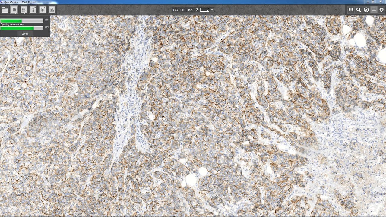 3DHISTECH - MembraneQuant